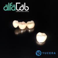 China Yucera 4D Pro Super Durable Dental Zirconia Block Compatible with CAD CAM System for Precise Restoration and a Refreshed Smile for sale