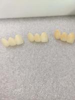 China 3D Plus Multilayer 43% -57% 6 Layers 3D Zirconia Dental Block Disc CAD CAM 95mm System for Dental Lab with ISO CE Certificate for sale