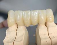 China Yucera  3D Pro Multilayer Multilayer Zirconia Block Cad /cam System  Ceramic Block 95mm System  for  Dental Lab for sale