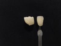 China Yucera  3D Pro Multilayer Multilayer Zirconia Block Cad /cam System  Ceramic Block 95mm System  for  Dental Lab for sale