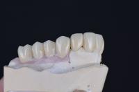 China Yucera 4D Plus Multilayer Zirconia Block 95 mm Yucera Dental Zirconium Block for  CAD/CMD Lab for sale