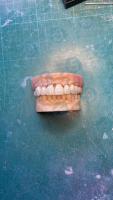 China Yucera 4D Pro High-Performance Dental Zirconia Blocks for Precision Milling for sale