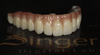 China Yucera 4D Pro Zirconia Blocks the Choice for Dental Professionals for sale