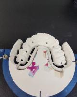 China Yucera 4D Pro Zirconia Blocks the Choice for Dental Professionals for sale