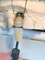China YUCERA Good Quality and Price Dental Materials and Laboratory Materials Dis and Dental Zirconia Block for sale