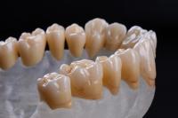 China YUCERA Good Quality and Price Dental Materials and Laboratory Materials Dis and Dental Zirconia Block for sale