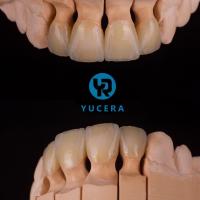 China YUCERA 3D Plus Multicapa Superventas De Alta Resistencia 3D Multicapa Pre-Shades Zirconia Bloque Para Lab Dental Sistema CAD CAM for sale
