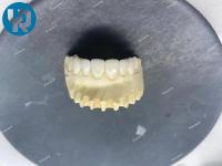 China Dental Lab CAD CAM Super Translucent Zirconia Block Dioxide Zirconium Disc Beautiful Porcelain Aesthetics 10-25mm Sizes for sale