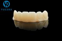 China Dental Lab CAD CAM Super Translucent Zirconia Block Dioxide Zirconium Disc Beautiful Porcelain Aesthetics 10-25mm Sizes for sale