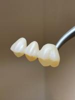 China Dental Lab CAD CAM Super Translucent Zirconia Block Dioxide Zirconium Disc Beautiful Porcelain Aesthetics 10-25mm Sizes for sale