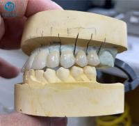 China Hot Sale 4D Dental Ceramic Pre-Shaded Multilayer  Zirconia Block Cad Cam Dental Lab for Half Mouth for sale