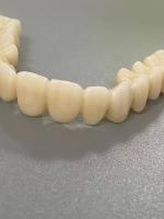 China Yucera CE Approved Dental Materials ST White Zirconia Ceramic Block Zirconio Dental Zirconias Blocked for sale