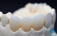 China Yucera Dental SHT Multilayer Zirconia Blocks Zirconia Ceramic Block 98mm Open System for Dental Cad Cam for sale