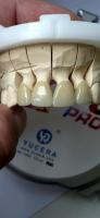 China Yucera 4D PRO Esthetic  Multilayer Zirconia Disk Disc Block Open System(98mm) for Dental Lab for sale