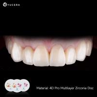 China Yucera High Translucent 98mm Zirconia Disc for Dental Crown and Bridge with 1200MPa Strength Lab Grade for sale