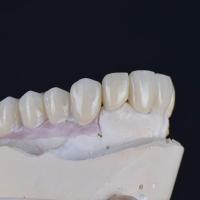 China Yucera 4D Plus Pre-shaded Multilayer Zirconia Blocks Dental Implant Orthodontic Materials Multilayer Zirconia 8 Layers for sale