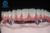 China Hot Sale 4D Dental Ceramic Pre-Shaded Multilayer  Zirconia Block Cad Cam Dental Lab for Half Mouth for sale