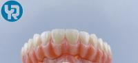 China Yucera 4D 98-A2 Multilayer Pro Zirconia Block Open System Thickness 14/16/18mm 16 Colors for Dental Lab CadCam Milling Material for sale