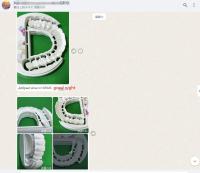 China Yucera 4D Pro Multilayer Dental 95*20 22 25mm Zirconia Disc Dental Lab Materials CAD CAM for sale