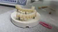 China Yucera 4D Pro Multilayer Dental Zirconia Ceramics Open System 98mm for Dental Lab and Cinic for sale