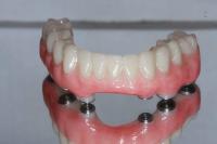 China Yucera  98*22mm Dental PMMA Blocks  CADCAM Multilayer PMMA Pink Disc for sale