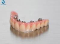 China Yucera  Cad Cam High-Quality Monolayer PMMA for Clear and Durable Dental Prosthetics for sale