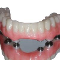 China Yucera Advanced Stability Dental Monolayer PMMA  for Robust Dental Applications for sale
