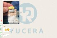 China Yucera DJ89 Plus Desktop Dental 3D Printer - RevolutionizeDental Lab with Crisp 4K Resolution for sale