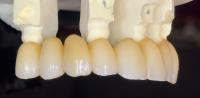 China Yucera 4D Pro Zirconia Blocks for Dental Laboratories for sale