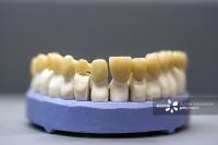 China Yucera STwhite Dental Zirconia Discs - The Ideal Complement to Our Top - Notch Blocks for sale