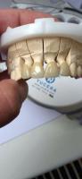 China Yucera ST color Dental Zirconia Blocks - Ideal for Precise Dental Restorations for sale