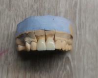 China Yucera ST color Dental Zirconia Blocks - Ideal for Precise Dental Restorations for sale
