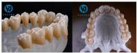 China 4D Pro Multilayer Zirconia Block with 700-1200Mpa Bending Strength and 43%-57% Transmittance for Dental Restoration for sale