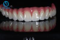 China 46% Transmittance Economical Dental Zirconia Blocks For Dental Equipments for sale