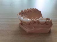 China SHT Ultra Ceramic Zirconia Blocks Dental 900 MPa High Flexural Strength for sale