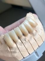 China 57% High Translucent 1050 Mpa Dental Zirconia Discs 20mm 22mm 25mm for sale