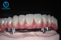 China 57% High Translucent 1050 Mpa Dental Zirconia Discs 20mm 22mm 25mm for sale