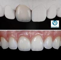China 98 95 System 3d Pro Plus Multilayer Zirconia Dental Blocks Vita 16 Color for sale