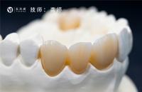 China 3D Pro Multilayer Dental Zirconia Discs For CAD CAM CNC Milling Machine for sale