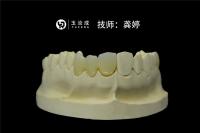 China Preshaded 3D Plus Multilayer Dental Zirconia Disc D98 Open System for sale