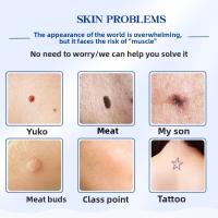 China Rechargeable Nine-Speed ABS Dot Pen Handheld LED Indicator and USB Plug for Home Beauty Freckle Spot Removal for sale