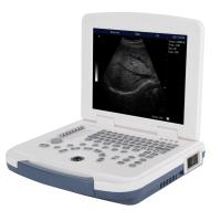 China China cheapest medical portable  full digital color doppler b ultrasound scanner/scan/machine price for pregnancy with p for sale
