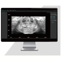 China Dental Intelligent 2D CT Panorama X Ray Machine Irradiation Ceph Panoramic Imaging for sale