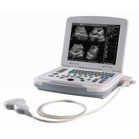 China B/W laptop ultrasound machine for sale