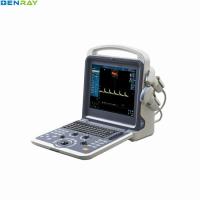China Portable Color doppler ultrasonic Diagnostic System  80 elments for sale