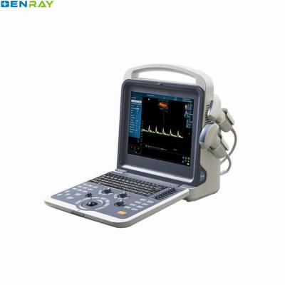 China Portable Color doppler ultrasonic Diagnostic System  80 elments for sale