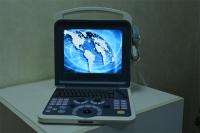 China Portable Color doppler ultrasonic Diagnostic System  80 elments for sale