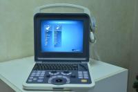 China Portable Color doppler ultrasonic Diagnostic System  80 elments for sale