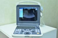 China Portable Color doppler ultrasonic Diagnostic System  80 elments for sale