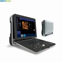 China Medical Ultrasound Device 4D Portable Color Doppler Machine for sale